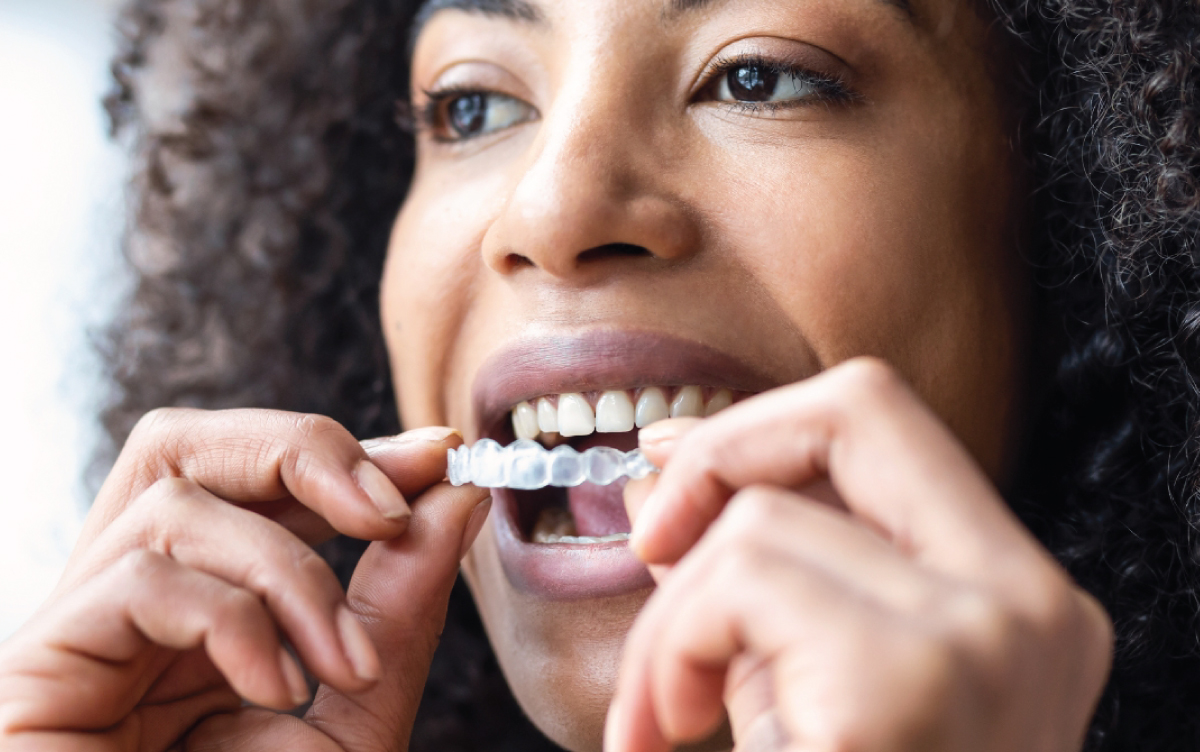 Clear Aligners - PG Health | Dentistry, Optometry & Medical Surgery